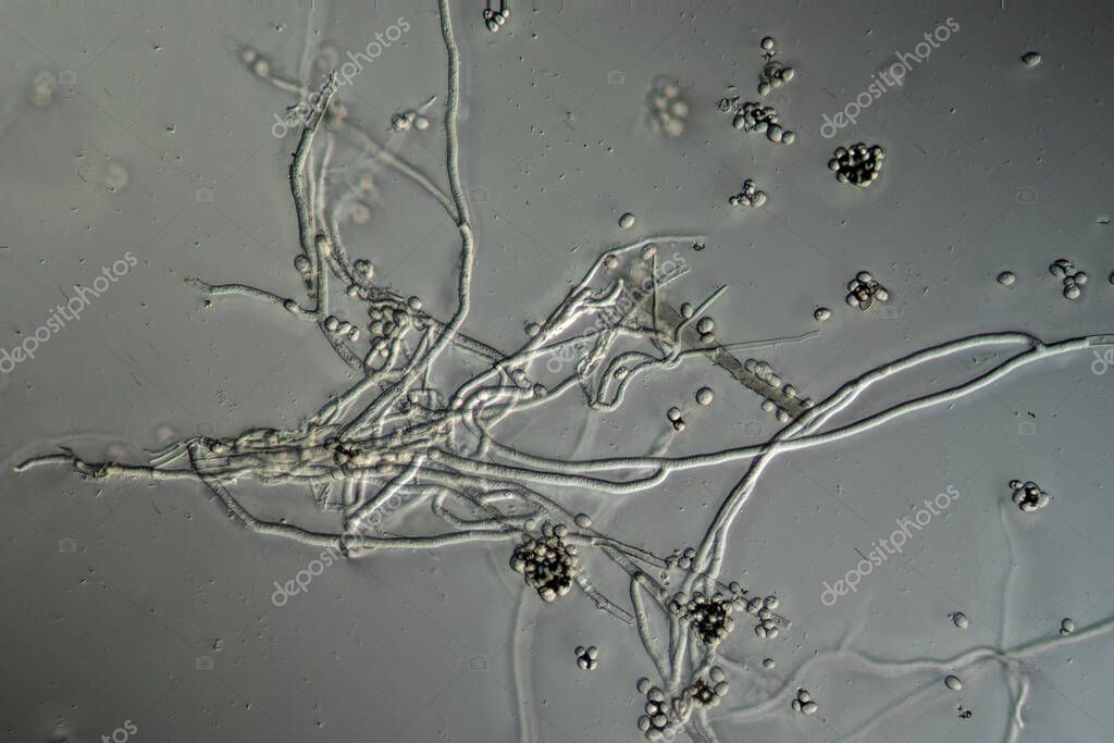 Filamentos de moho y esporas del molde de Aspergillus bajo el ...