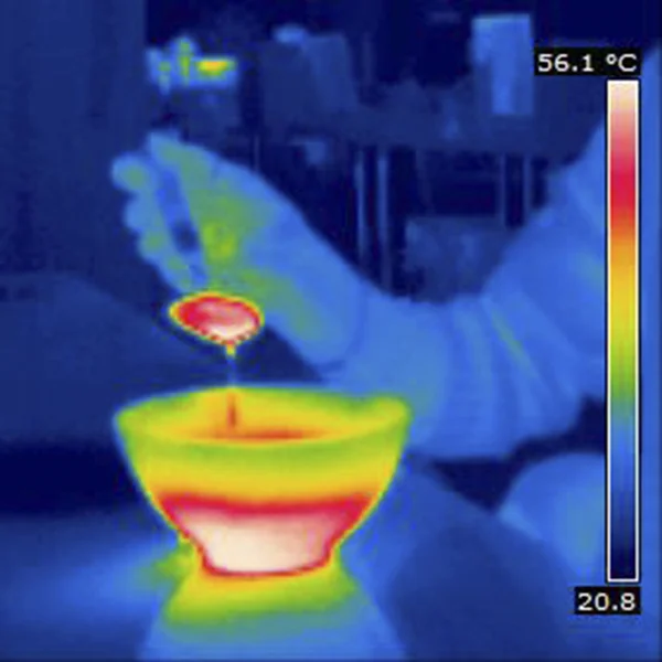 THERMOGRAM - Stock Image - Everypixel