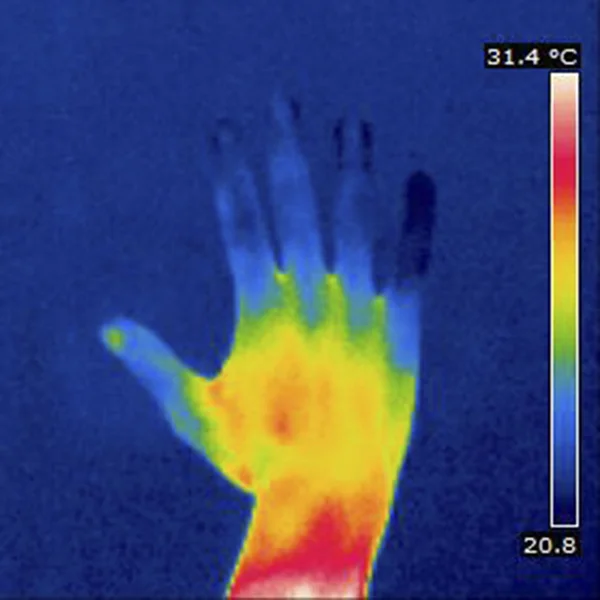 Thermography Stock Photos, Royalty Free Thermography Images | Depositphotos