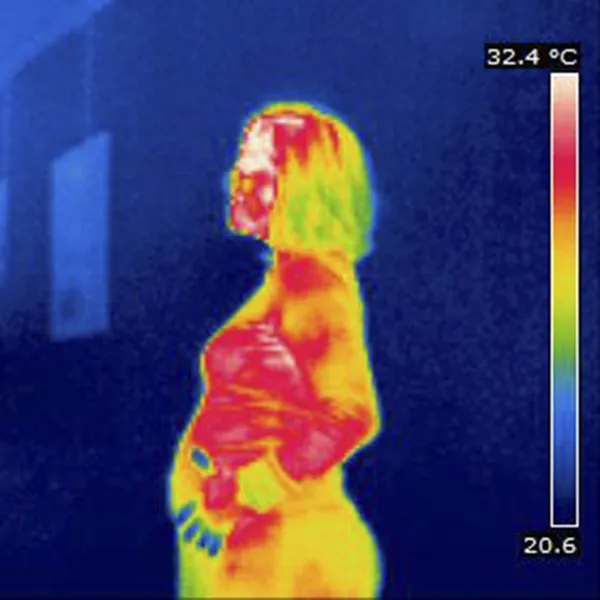 Thermography Stock Photos, Royalty Free Thermography Images | Depositphotos