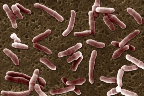 Leprosy Bacteria Electron Micrograph