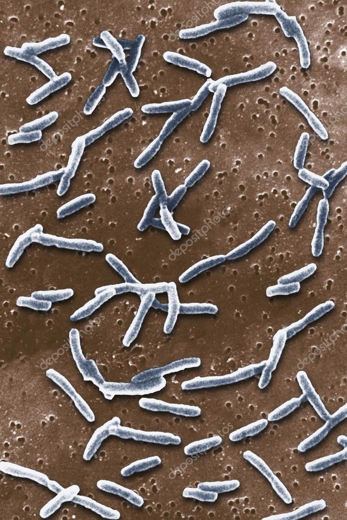 Aerobio bajo microscopio electrónico 2024