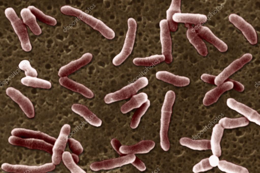 Actinomicetos bajo microscopio electrónico — Foto de Stock #42560881 ...