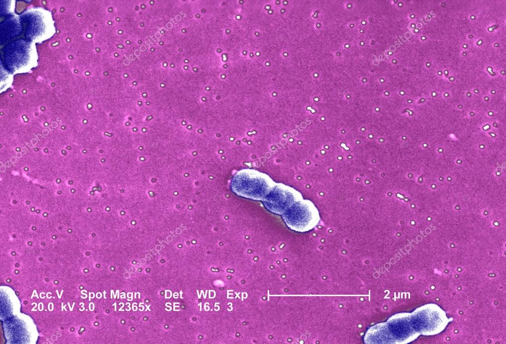 bacteria Acinetobacter baumannii 2024 bacteria Acinetobacter baumannii 2024