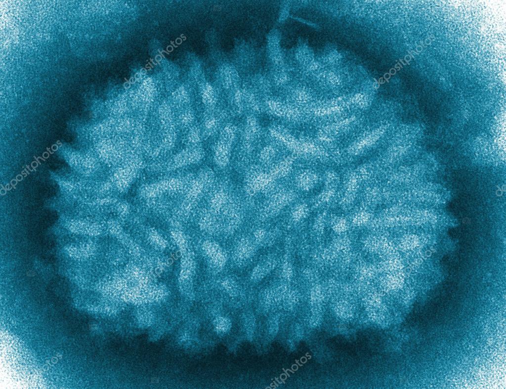 Virus under microscope Stock Photo by ©imagepointfr 44393923