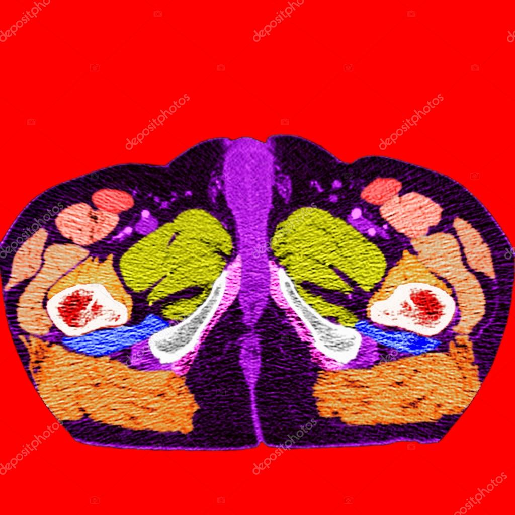 Pelvis y perineo del hombre: fotografía de stock © imagepointfr ...