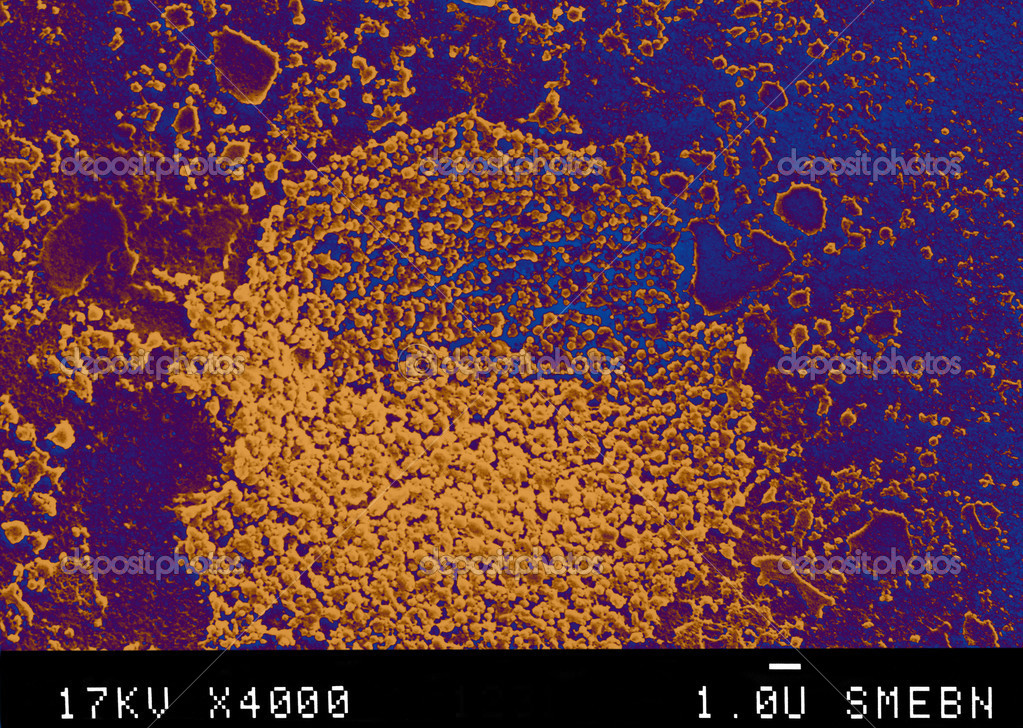 Mycoplasma hominis Stock Photo by ©imagepointfr 44394247