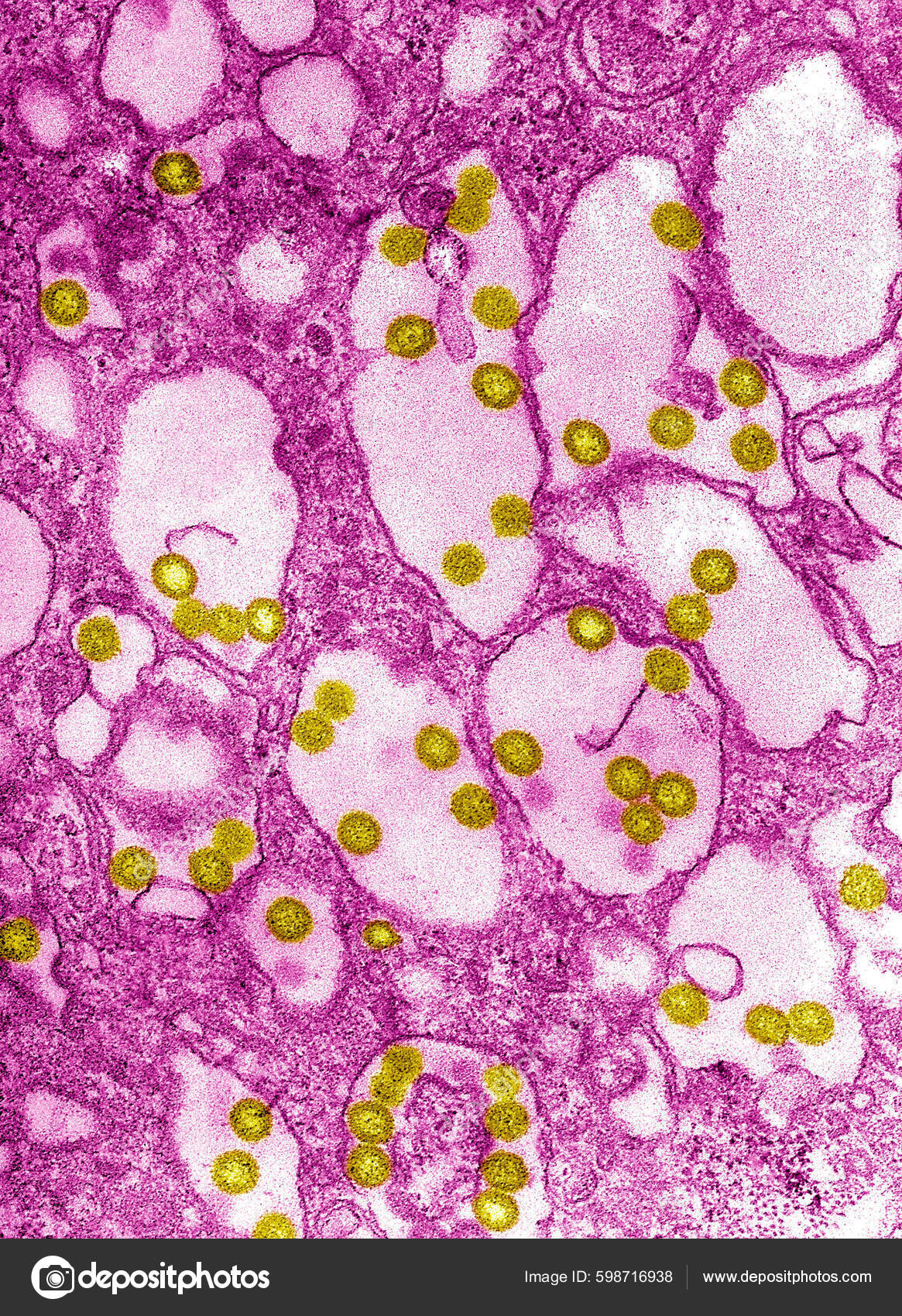 Electron Micrograph Rift Valley Fever Virus Rift Valley Fever Rvf Stock ...