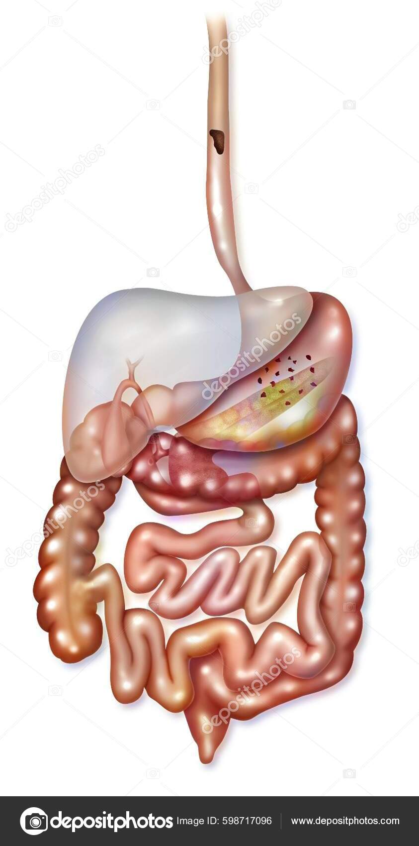 Digestive System Esophagus Stomach Duodenum Small Intestine: fotografía ...