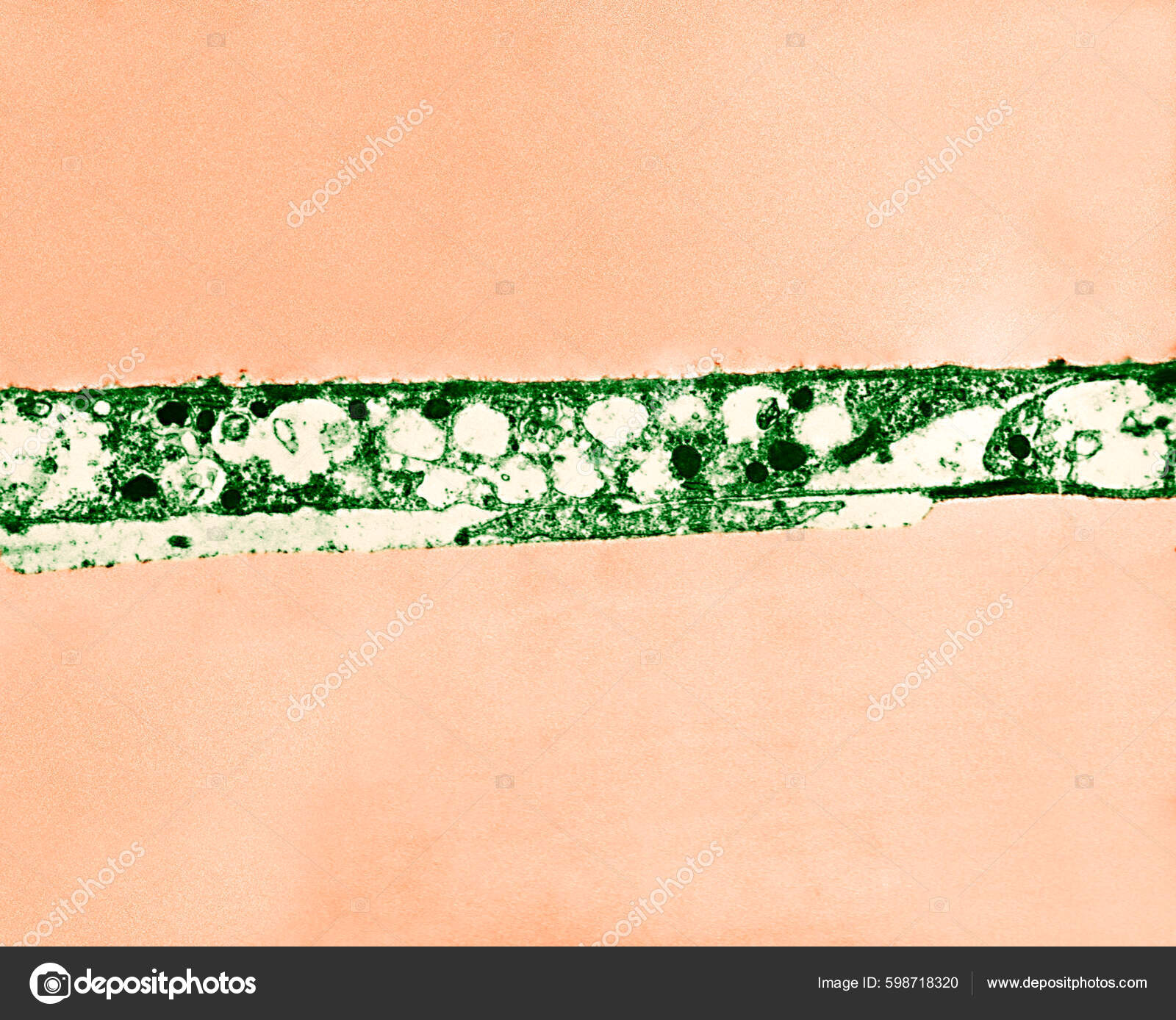 Syphilis Bacterium Treponema Pallidum Subsp Pallidum Cultures Cotton ...