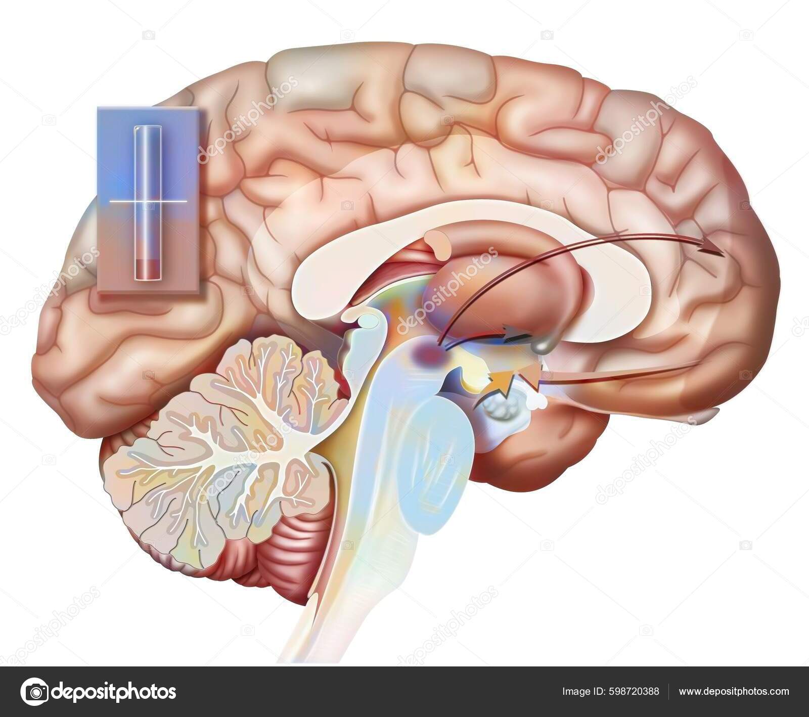 Frontal Lobotomy Diagram