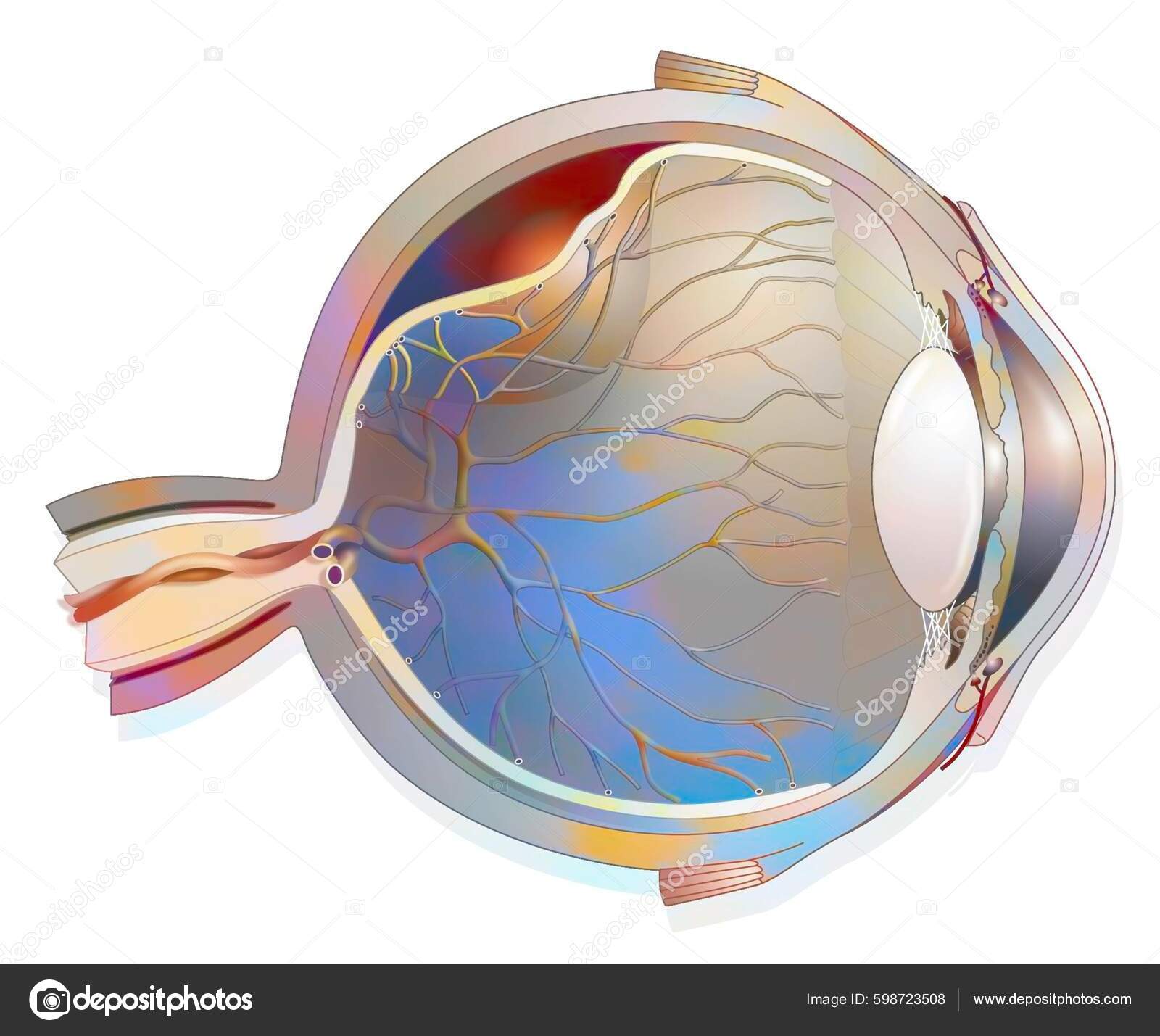 Eye Detachment Retina Which Detaches Underlying Choroid Stock Photo by ...