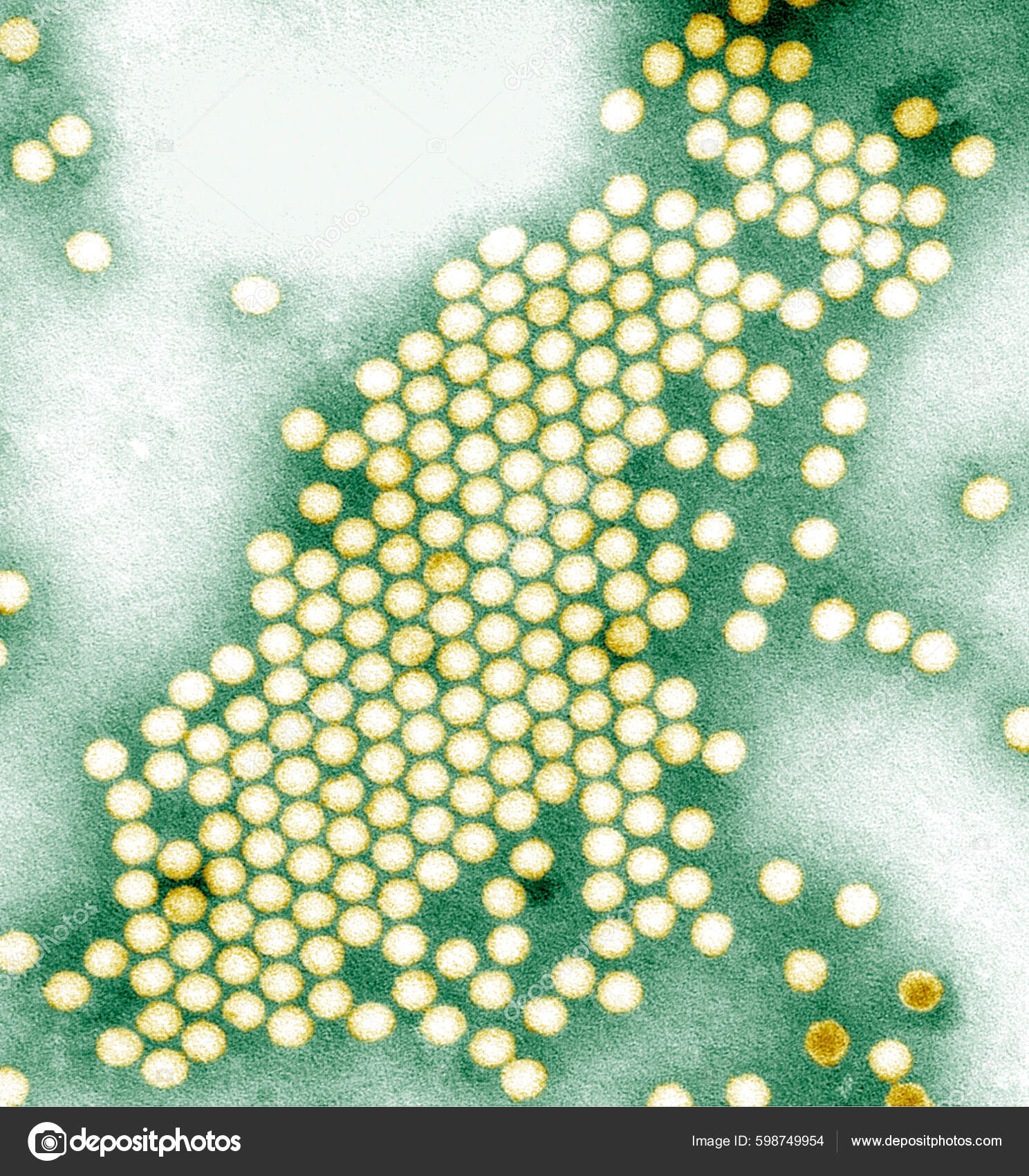 Polio Virus Under Microscope