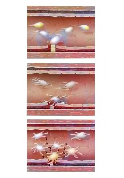 Coagulation process Stock Photos, Royalty Free Coagulation process ...