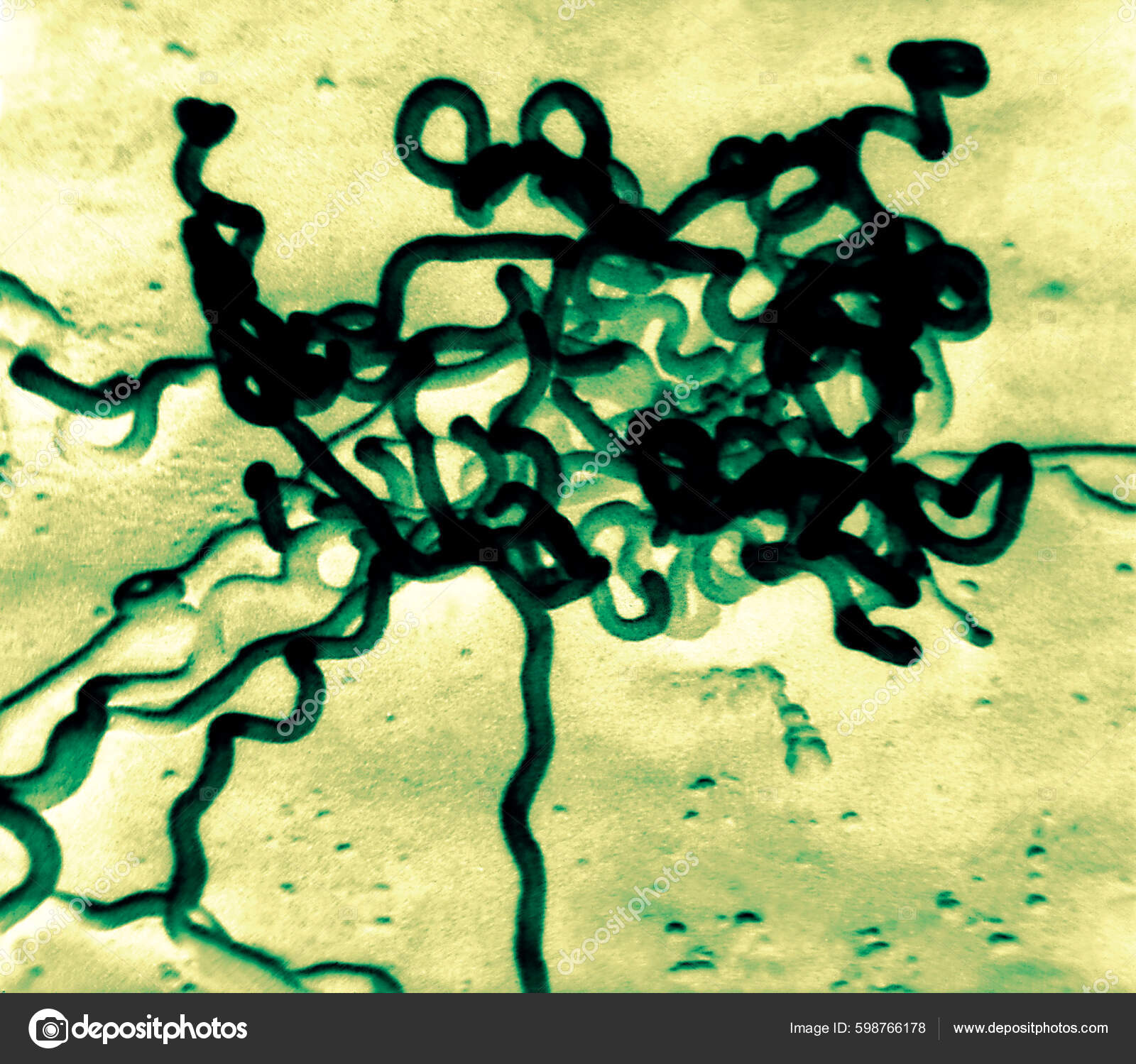 Treponema Pallidum Under Microscope