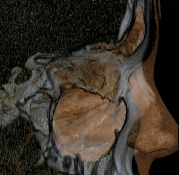 Face mri Stock Photos, Royalty Free Face mri Images | Depositphotos