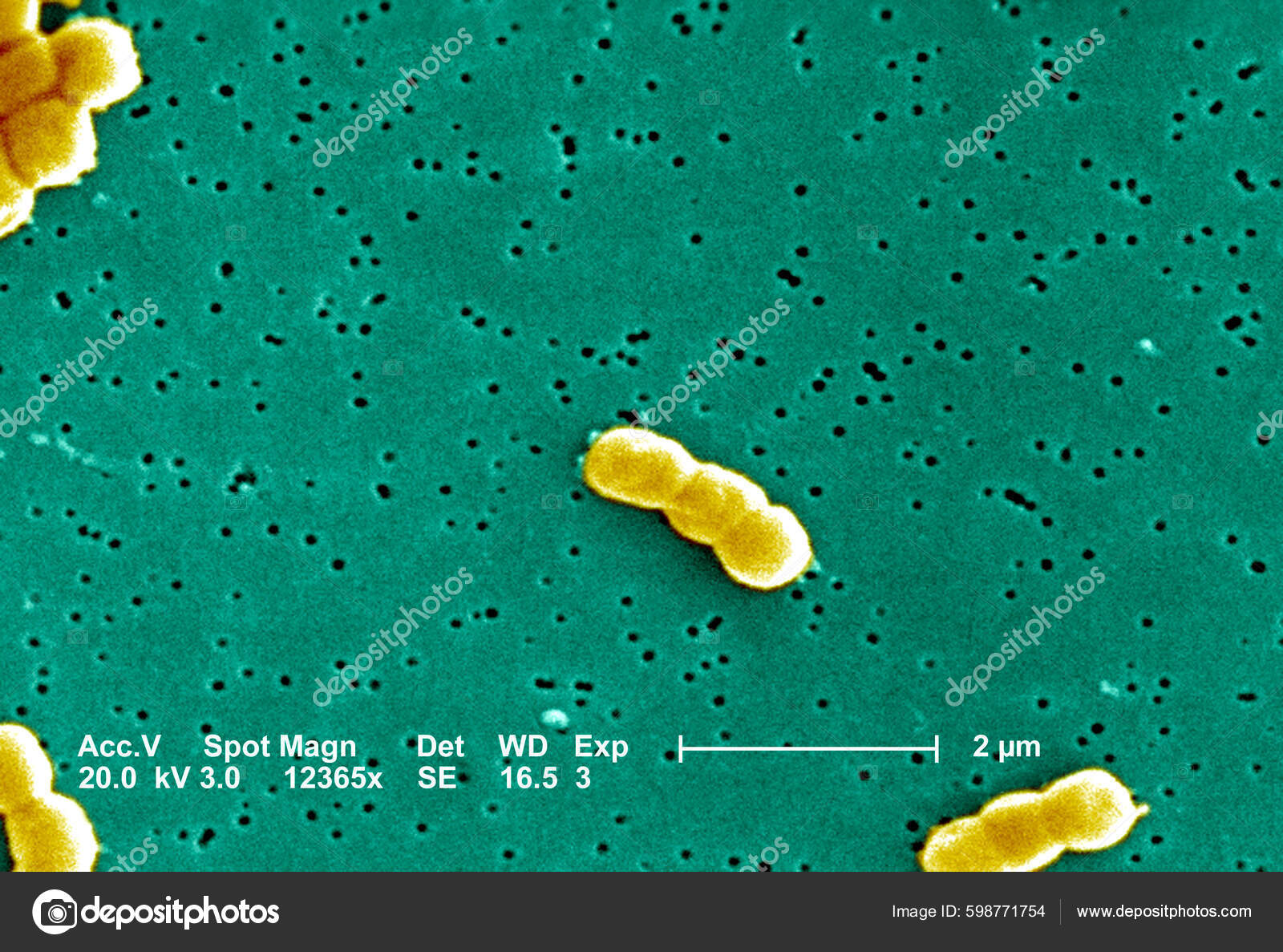 Acinetobacter Gram Stain