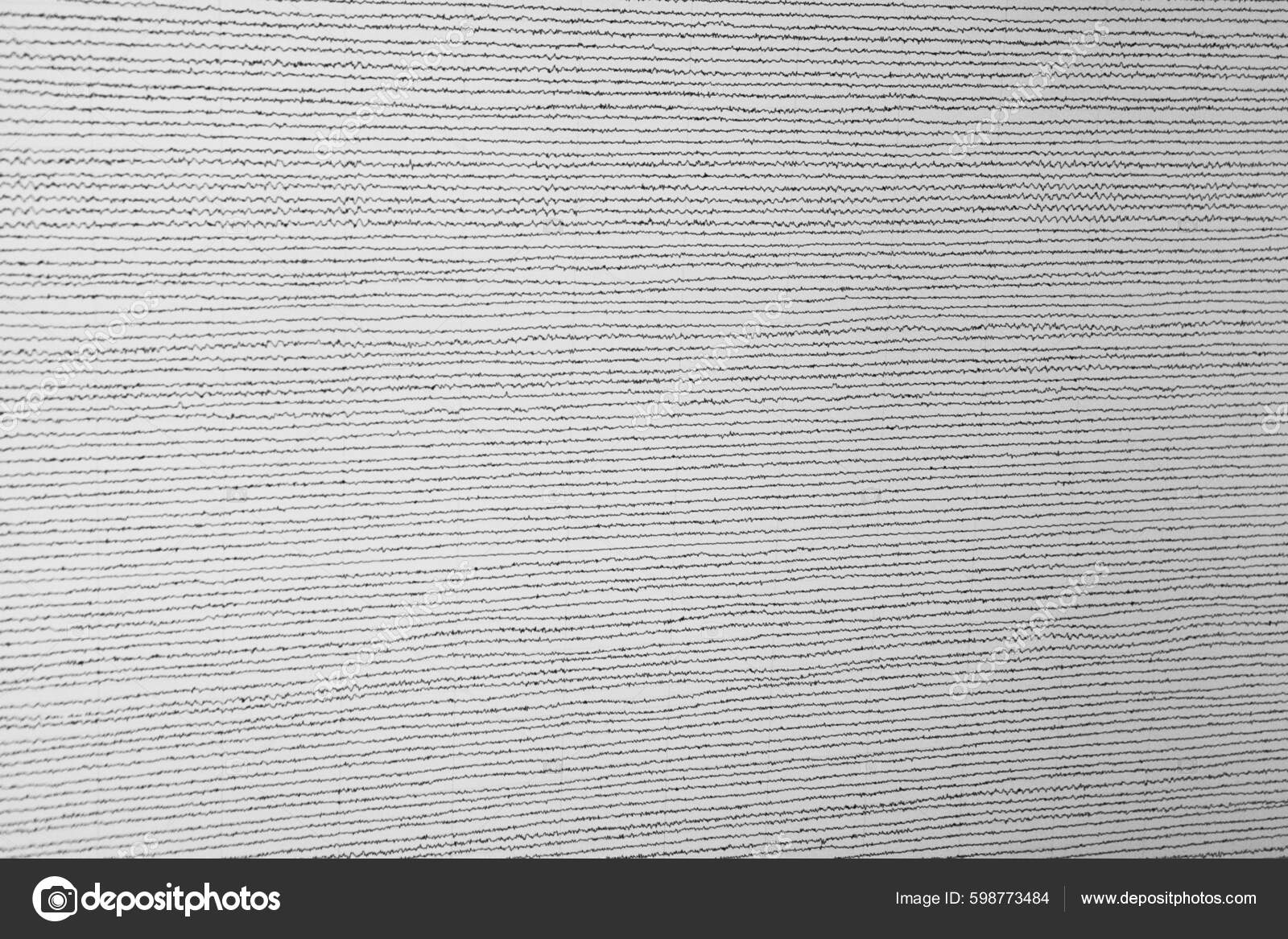 Magnetoencephalography Meg Neuroimaging Records Electromagnetic ...