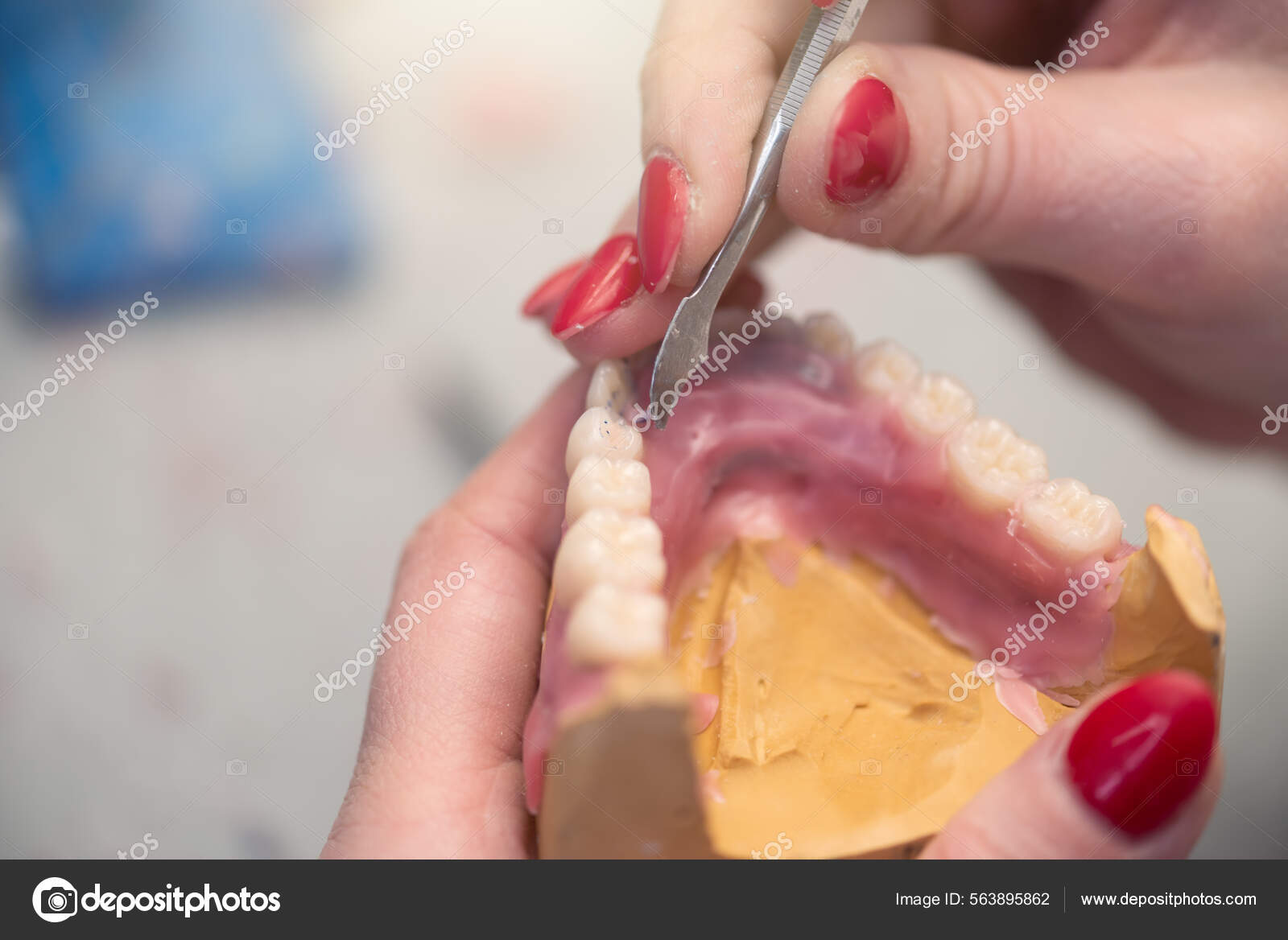 Dental Prosthesis Dentures Prosthetics Work Study Table Dental Tools ...