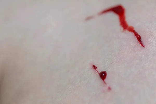 Wound pain Stock Photos, Royalty Free Wound pain Images | Depositphotos