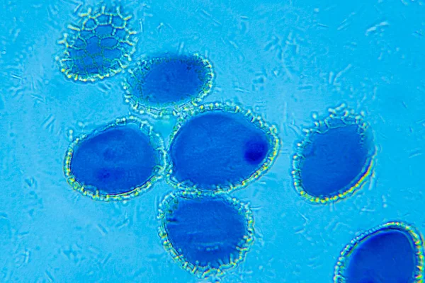 Chlamydia microscope Stock Photos, Royalty Free Chlamydia microscope ...