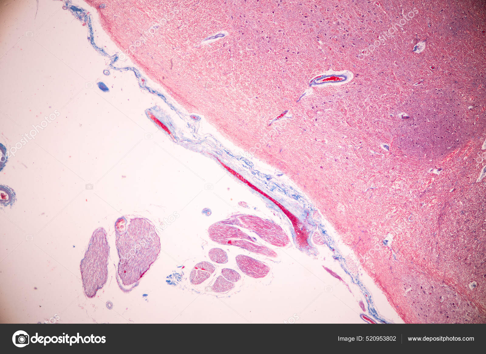 Cerebellum Thalamus Medulla Oblongata Spinal Cord Motor Neuron Human ...