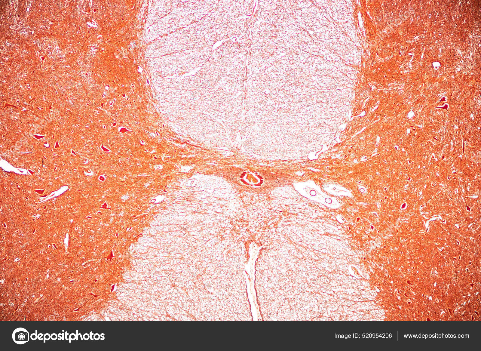 Cerebellum Thalamus Medulla Oblongata Spinal Cord Motor Neuron Human ...