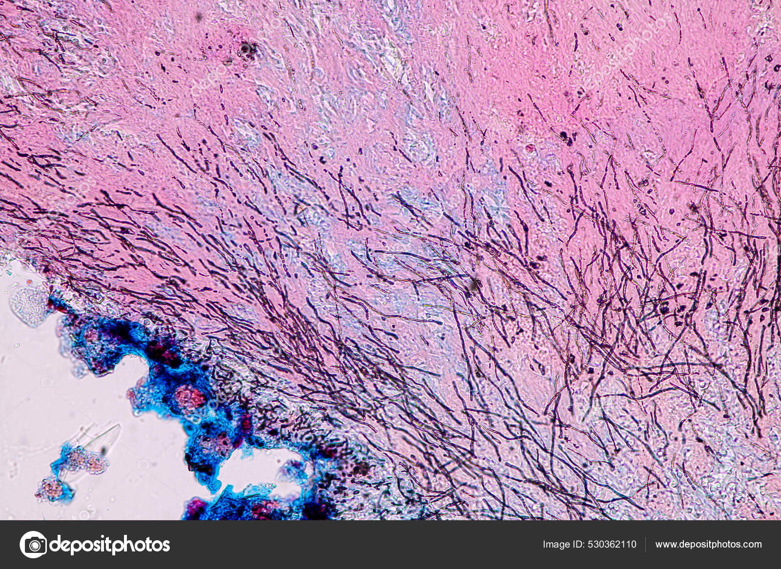 Microscopio Do Talo Do Liquen FUNGOS LIQUENIZADOS (LIQUENS)