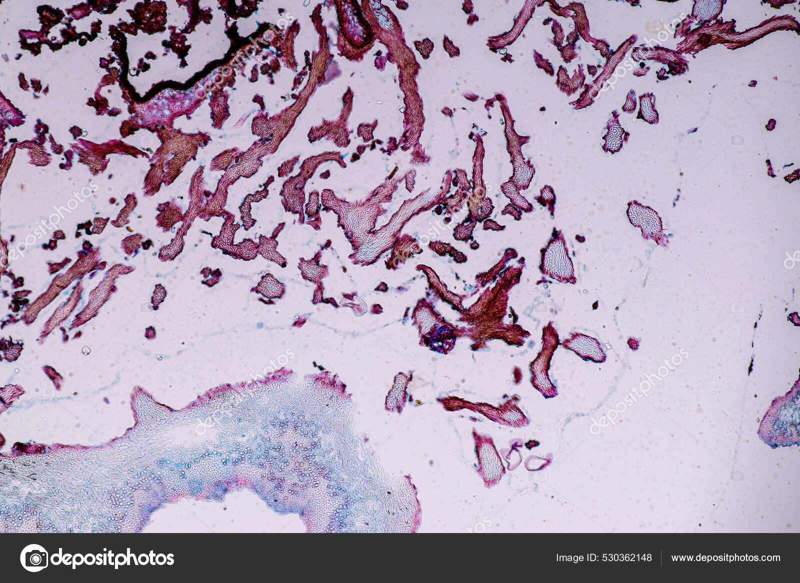 Lichens Under Microscope