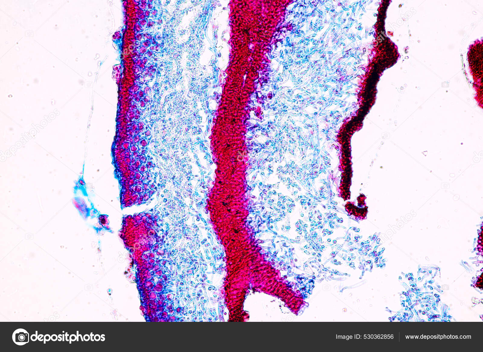Characteristics Lichen Hyphae Symbiotic Algae Microscope Education ...