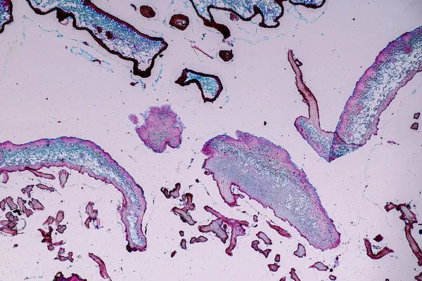 Lichen Thallus Microscope