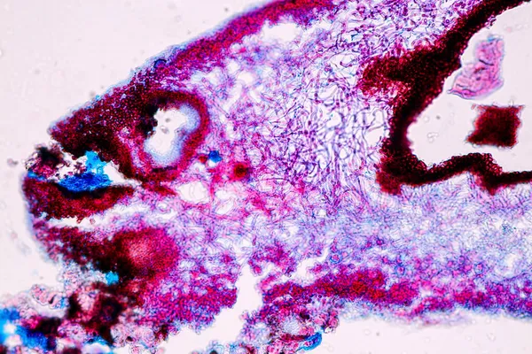 Características del liquen, las hifas y las algas simbióticas bajo el ...