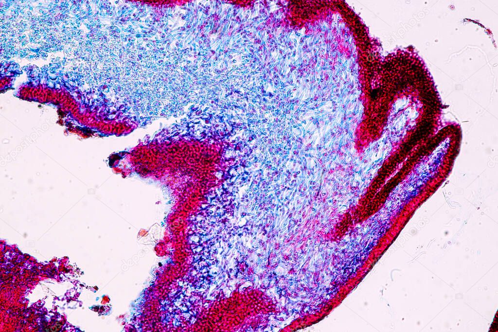 Características del liquen, las hifas y las algas simbióticas bajo el ...