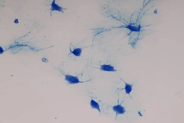 Microscope neurons Stock Photos, Royalty Free Microscope neurons Images ...