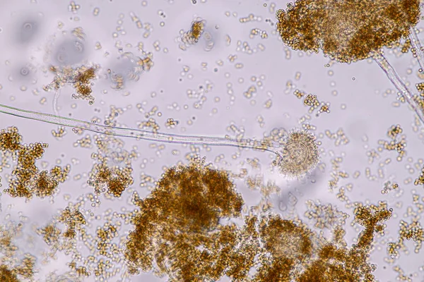 Water Molds Under Microscope