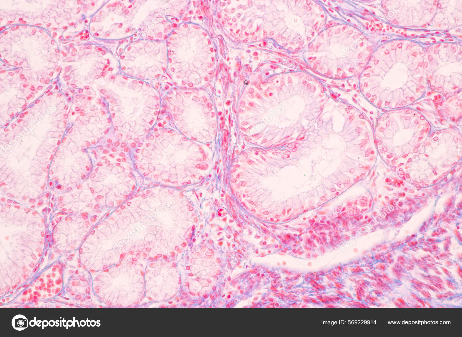 Simple Columnar Epithelium Kidney