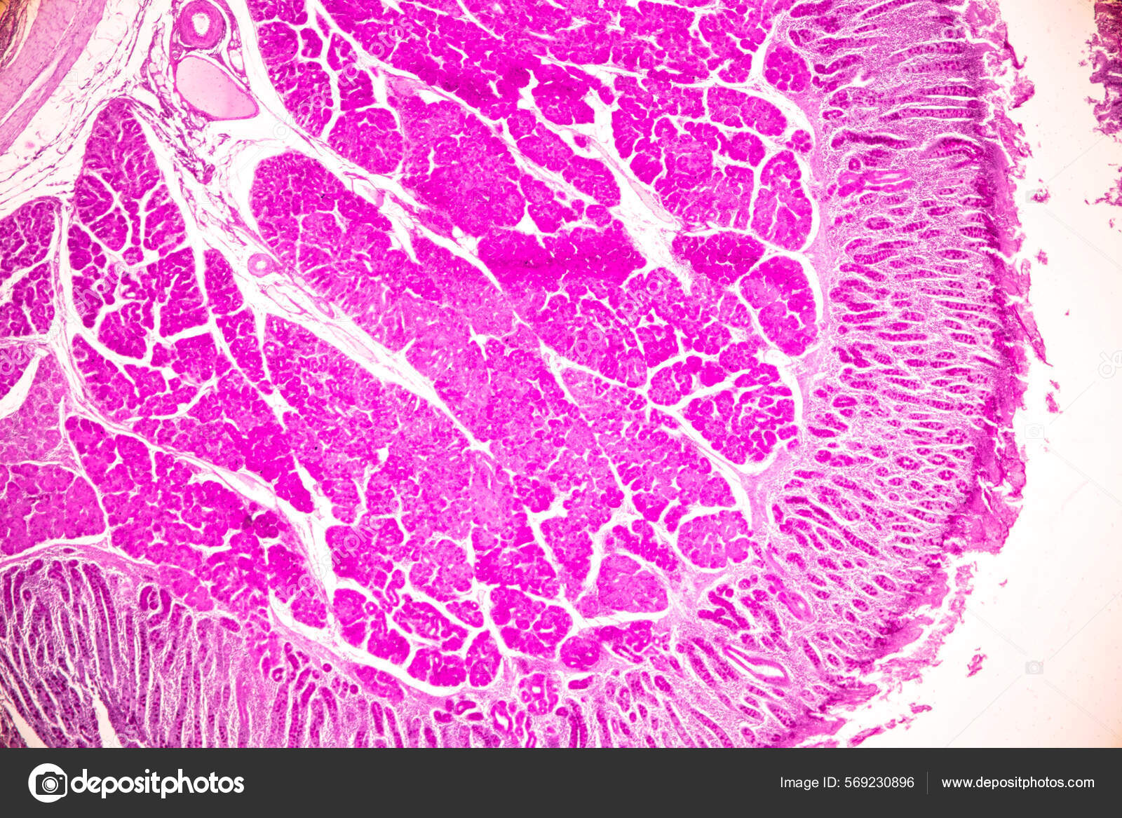 Tissue Small Intestine Duodenum Vermiform Appendix Human Microscope Lab ...