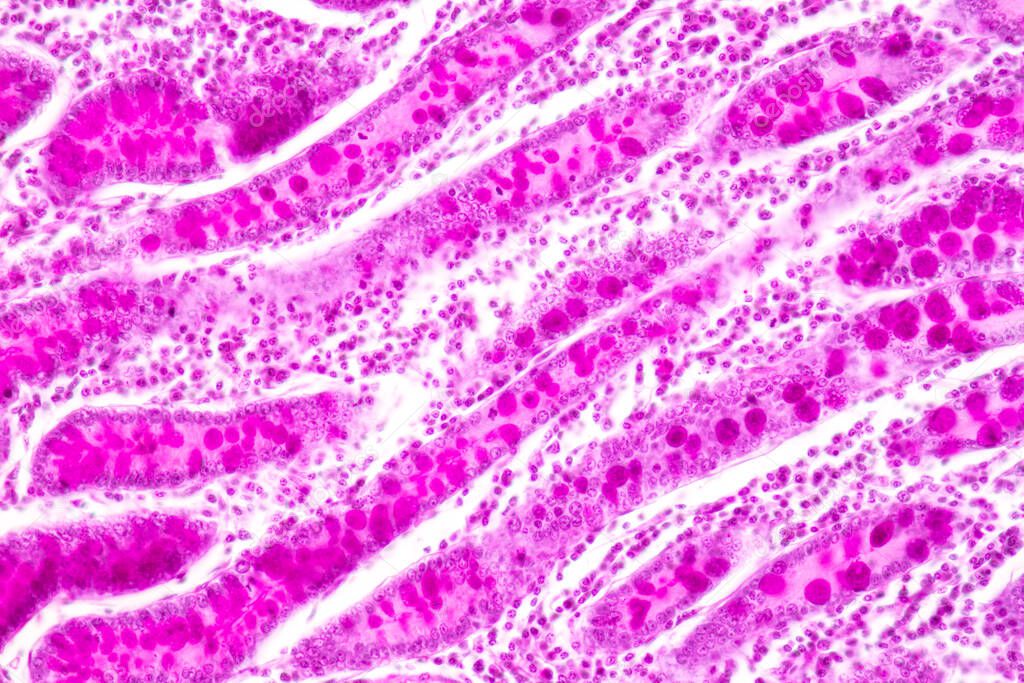 Tejido de intestino delgado (duodeno) y apéndice vermiforme humano bajo ...