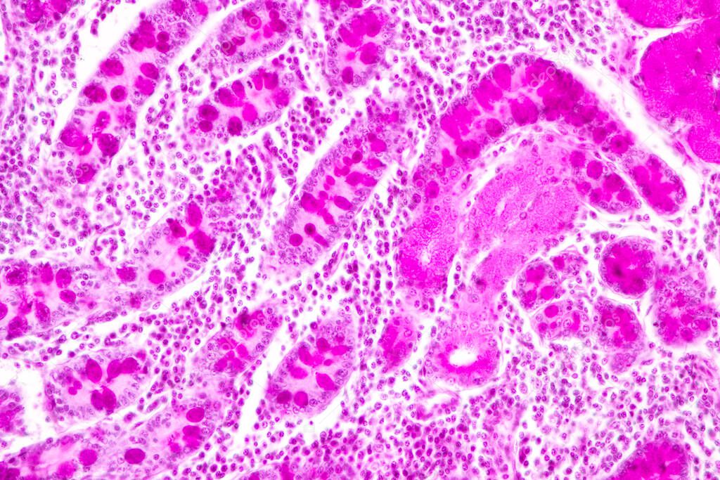 Tejido de intestino delgado (duodeno) y apéndice vermiforme humano bajo ...