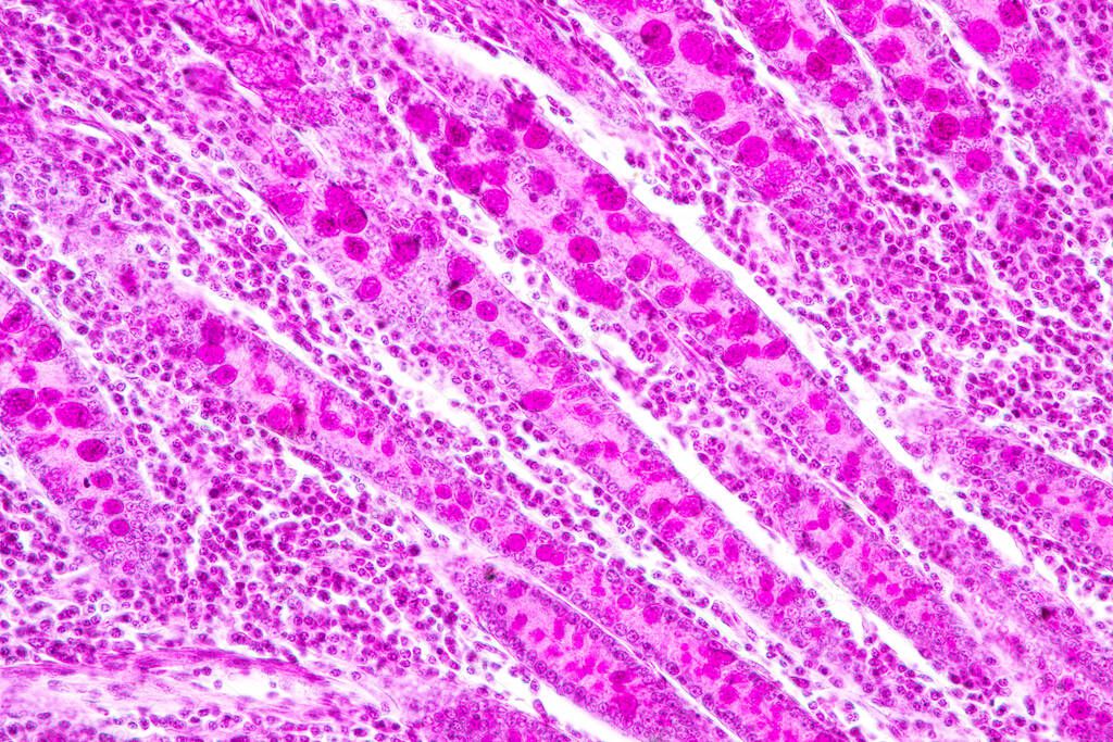 Tejido de intestino delgado (duodeno) y apéndice vermiforme humano bajo ...