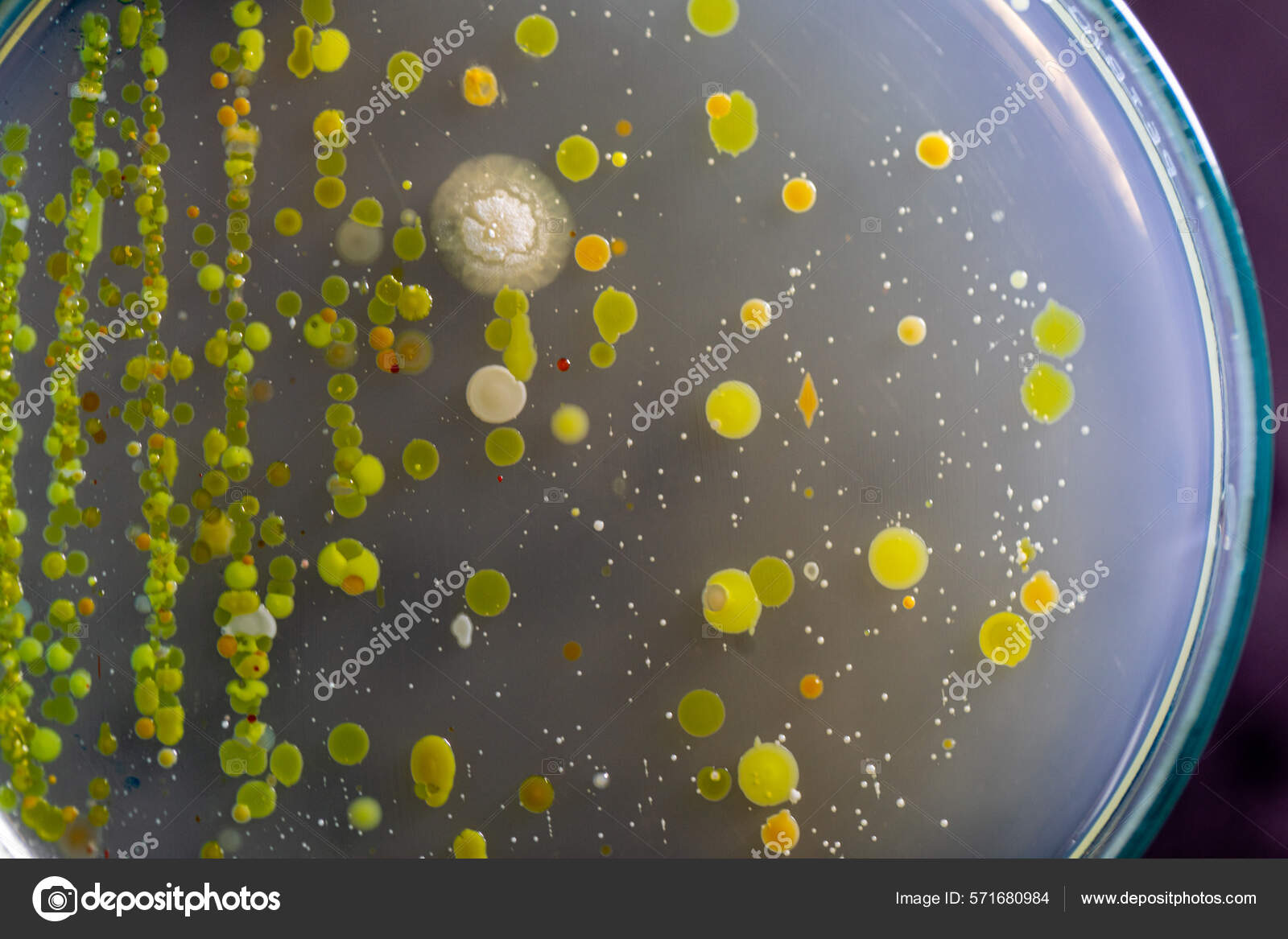 Actinomyces Colony Morphology