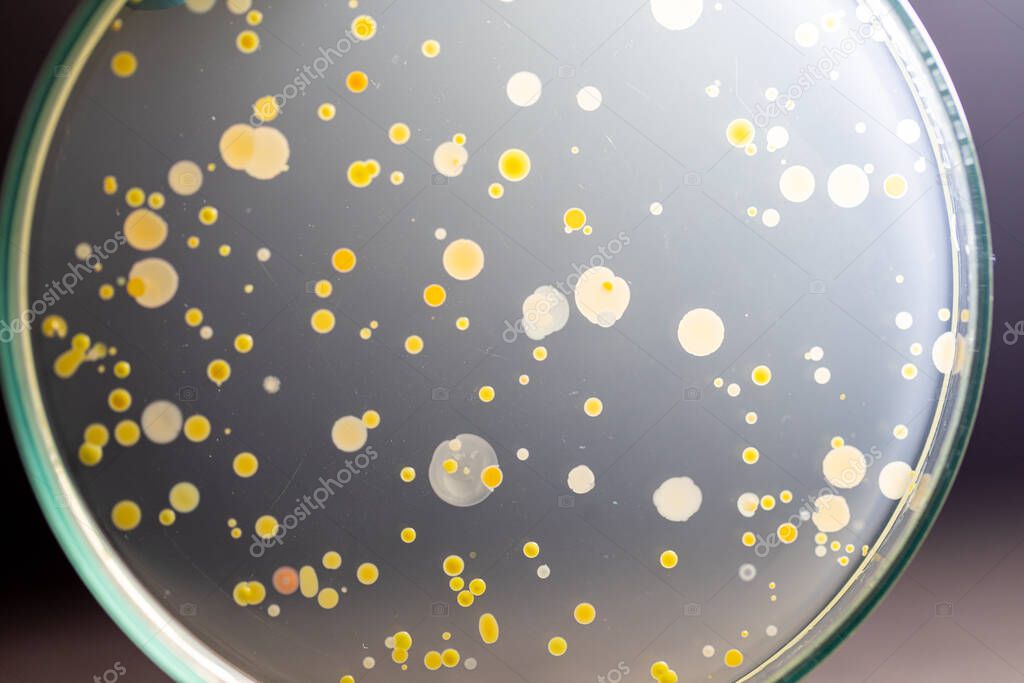 Antecedentes de características y diferentes formas de colonia de ...