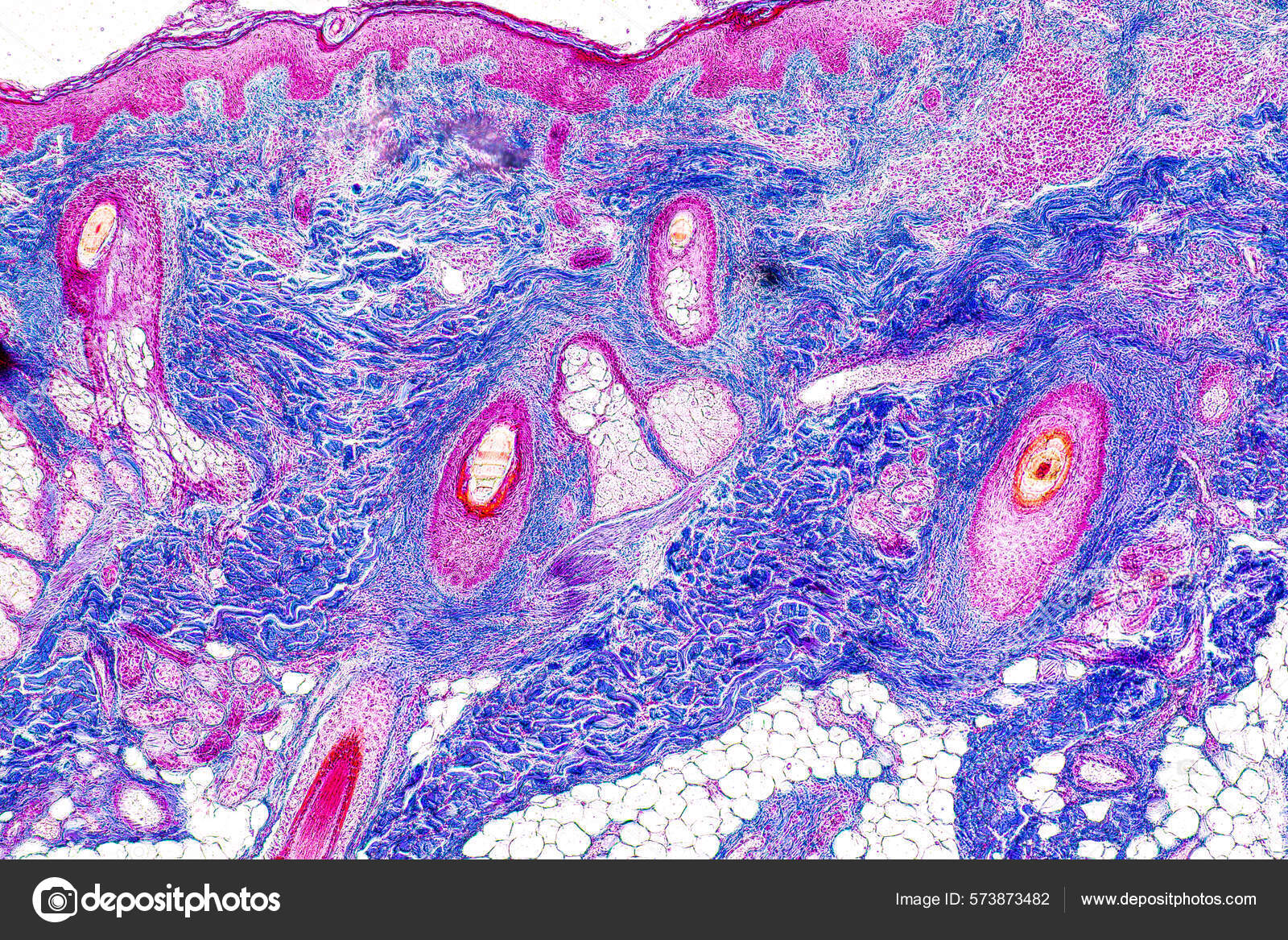 Scalp Hair Follicles Human Microscope Lab Stock Illustration by ©p ...