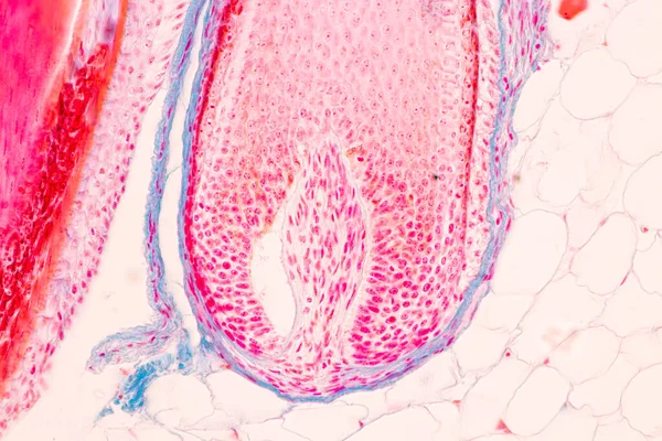 Scalp and hair follicles of human under the microscope in Lab. - Stock ...