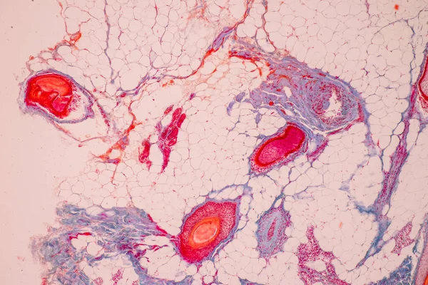 Scalp and hair follicles of human under the microscope in Lab. - Stock ...