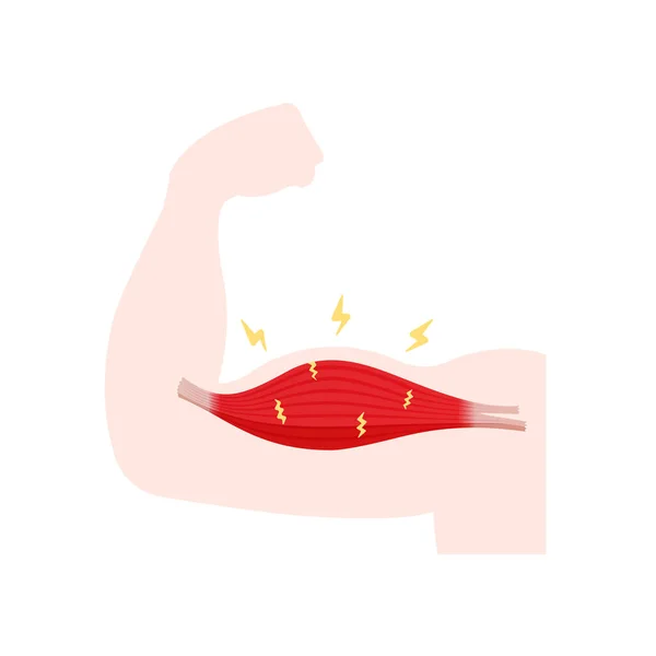 Supercompensation Vector Art Stock Images | Depositphotos