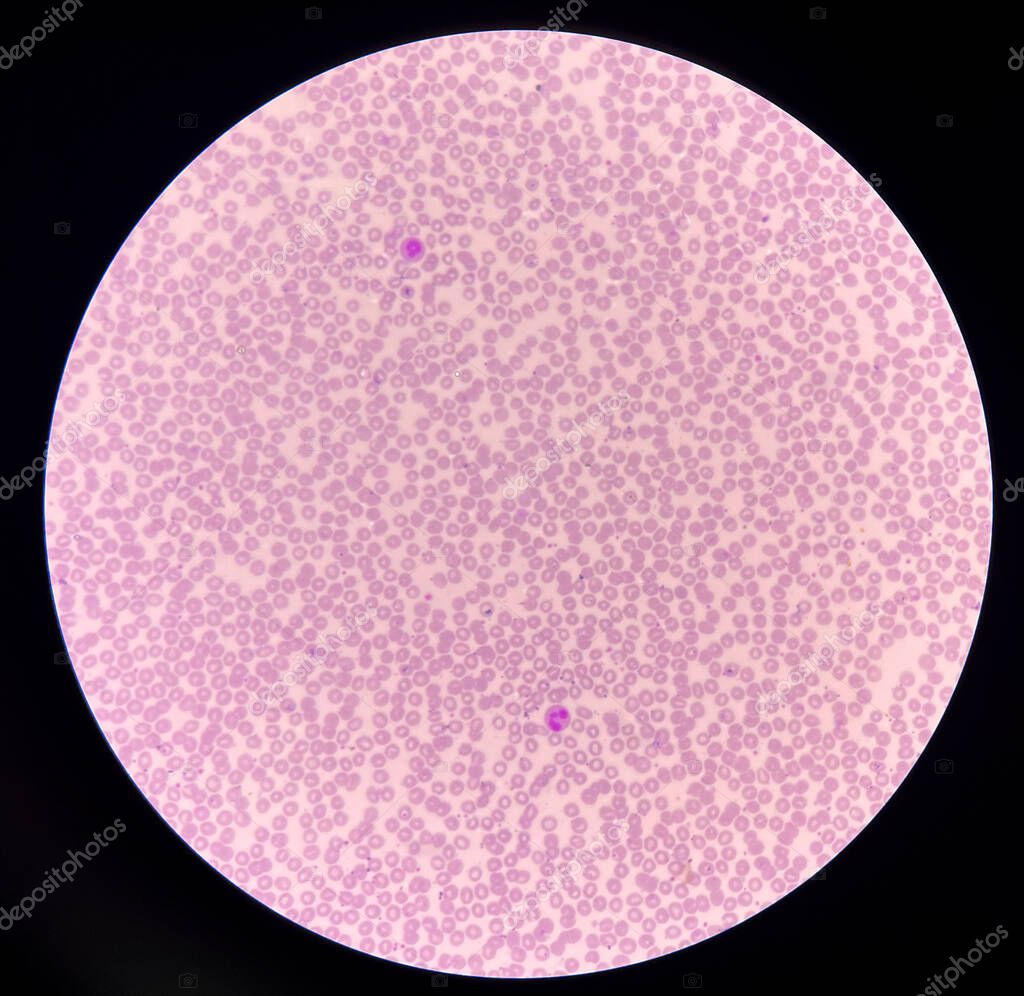 Red blood cell and white blood cells in 40X microscope Laboratory ...