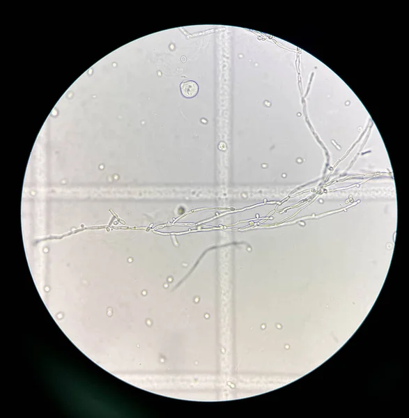 Pseudohyphae On Microscope