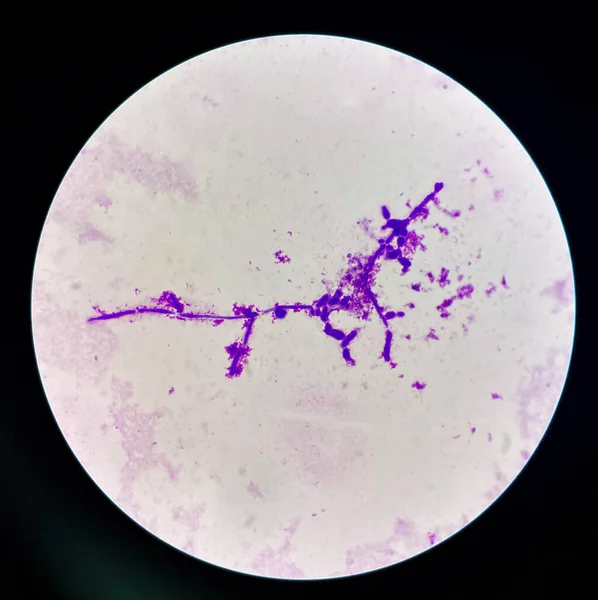 Staphylococcus Aureus 100x