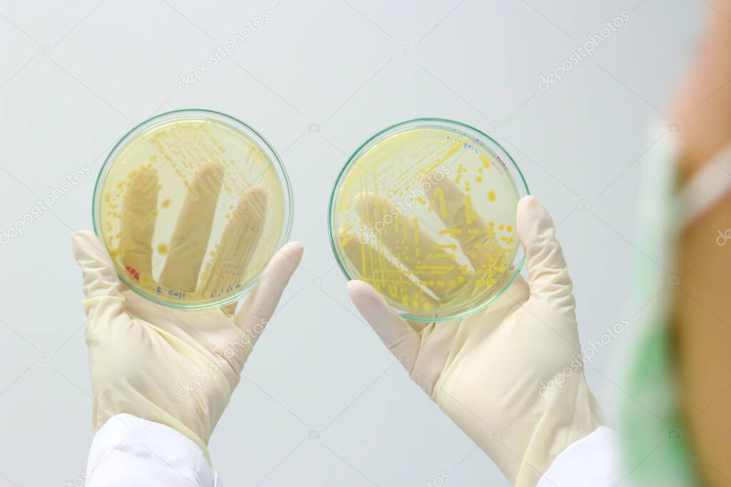 Microbiólogos mano sosteniendo plato con cultivos en crecimiento de ...